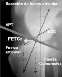 Fuerza Compresiva